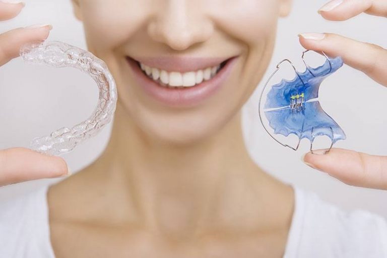 Orthodontic Retention | Orthodontist in San Jose, CA Orthodontic Retention | Orthodontist in San Jose, CA